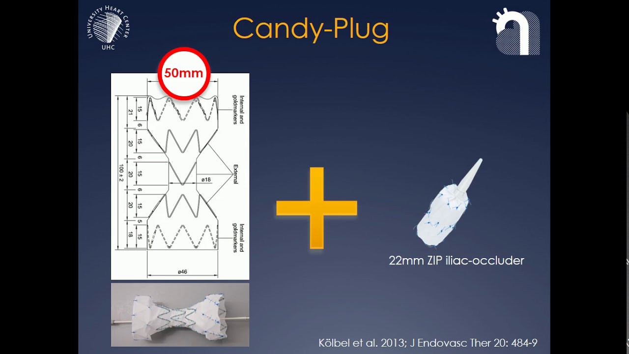 11.00-11.10: Adjunctive Techniques for Treating Chronic Dissection ...
