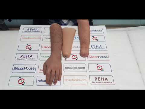 El Bilek Dezartikülasyonu Protezi / Elbow Disarticulation Prosthesis ...