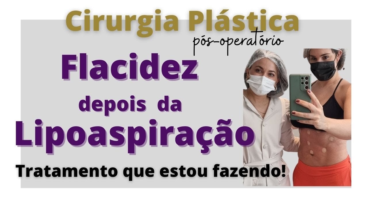 Flacidez de pele após a Lipoaspiração: veja o tratamento que estou ...