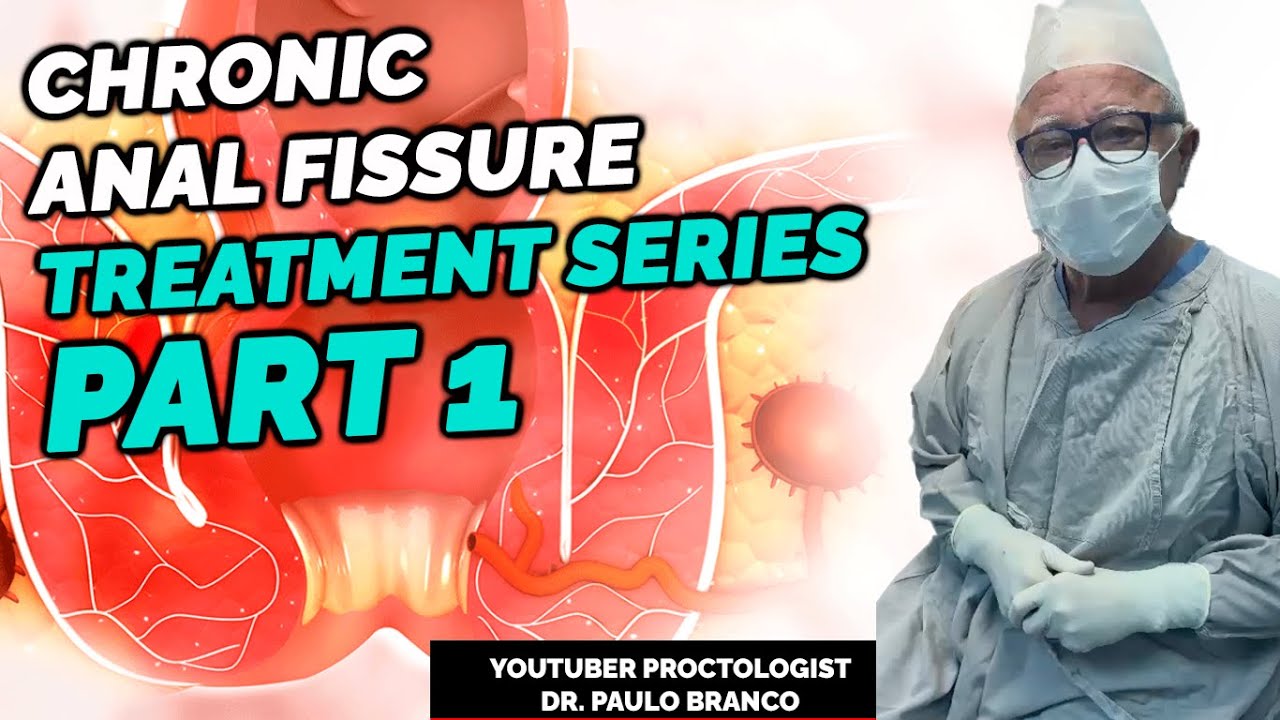 Anal Fistula Symptoms Explained by Dr. Paulo Branco - YouTube