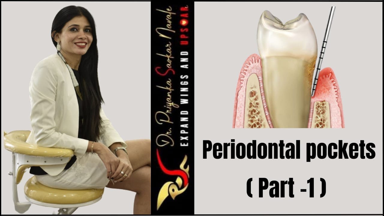 What are the Periodontal pockets? What are the types of Periodontal ...