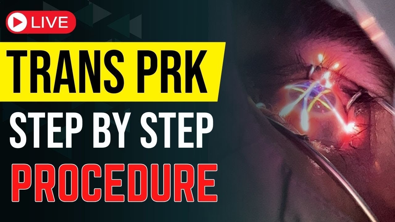 Trans Prk Specs Removal Surgery I Steps By Steps Surgery Procedure ...