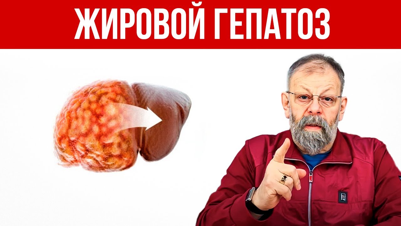 Жировой гепатоз (ожирение печени). Как очистить печень от жира? - YouTube