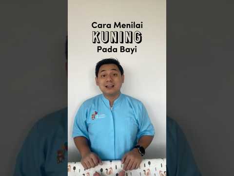 Cara praktis menilai kuning pada bayi dan kapan harus dibawa ke dokter spesialis anak.