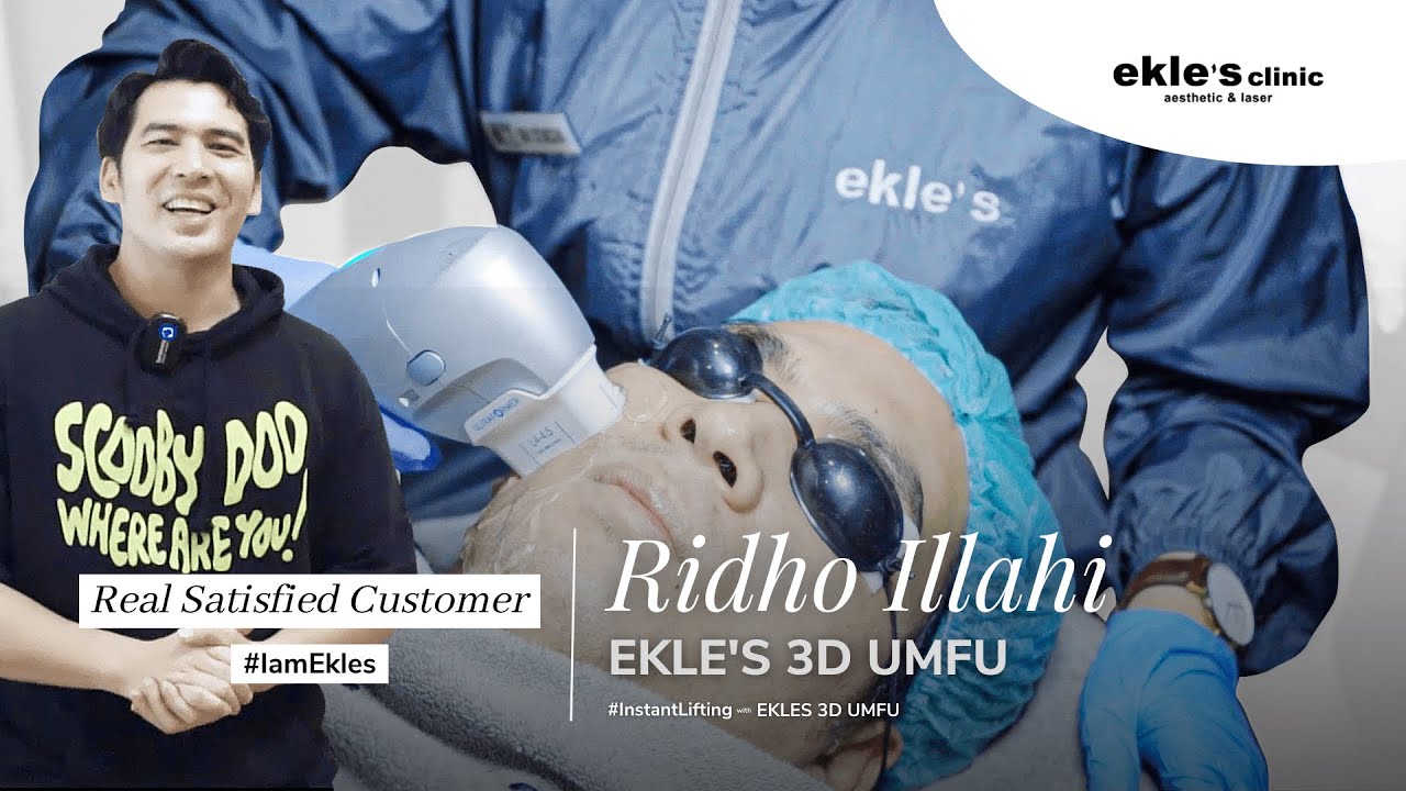 BIKIN MUKA TIRUS RIDHO ILAHI DALAM WAKTU 30 MENIT! | Ridho Illahi - YouTube