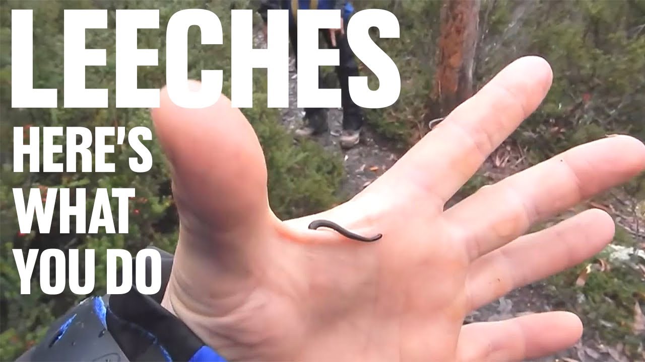 Leeches SUCK YOUR BLOOD // It's what they do best!! - YouTube
