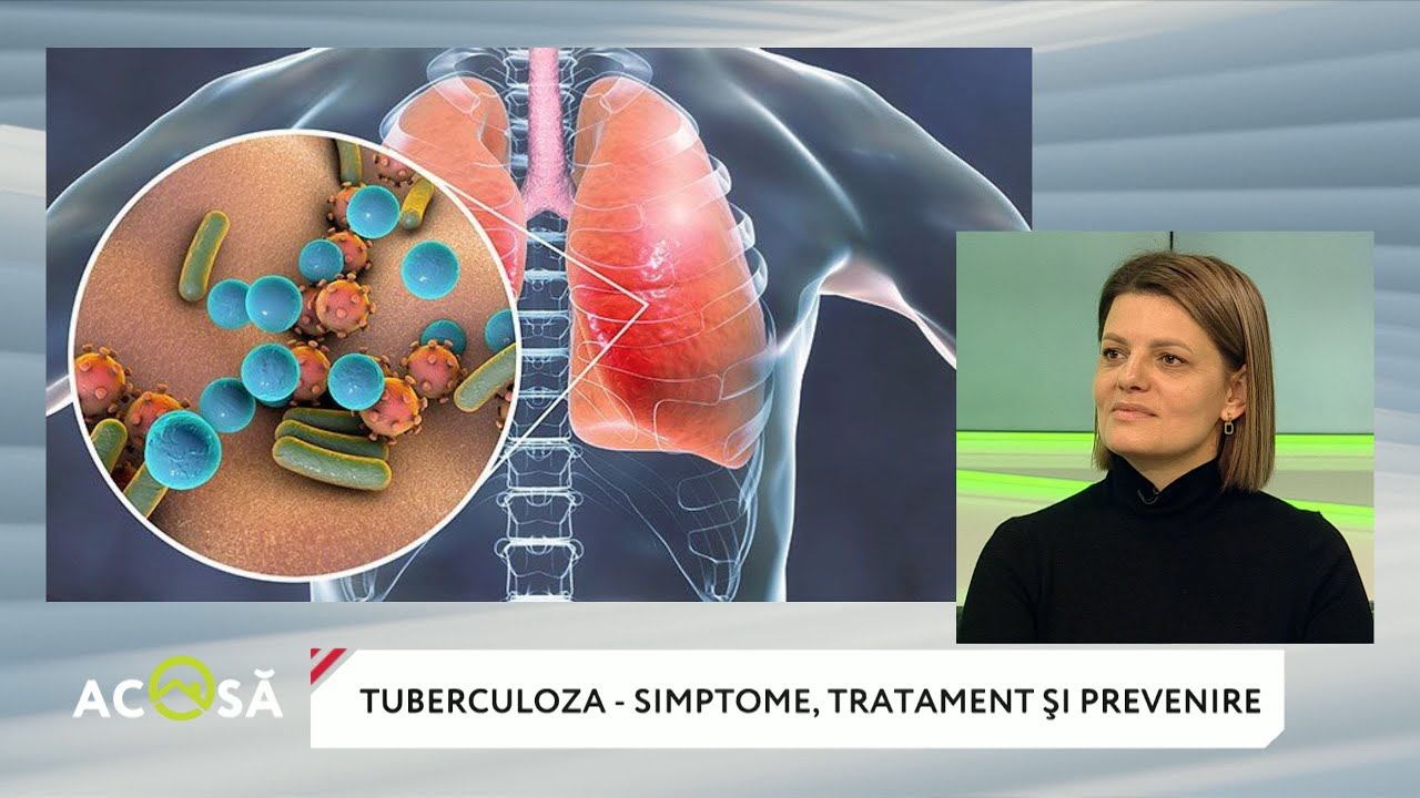 Tuberculoza nu este o sentinţă. Cum se tratează şi care sunt simptomele ...