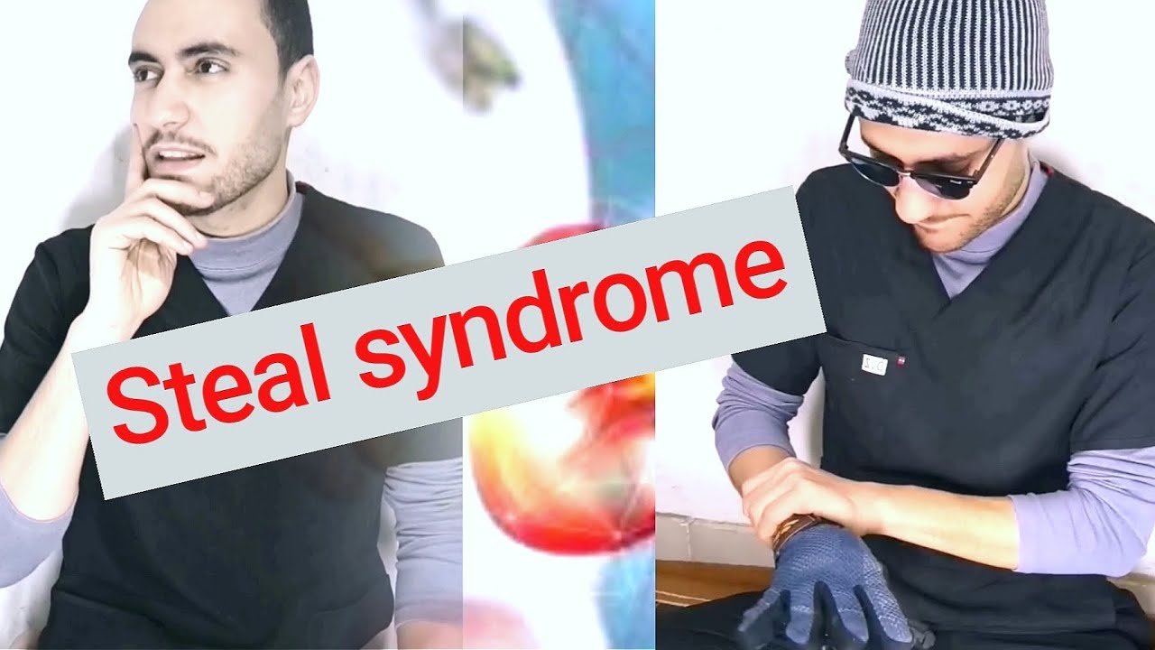 steal syndrome of Arterio venous fistuala(AVF)سبب البرودة وتنميل ...