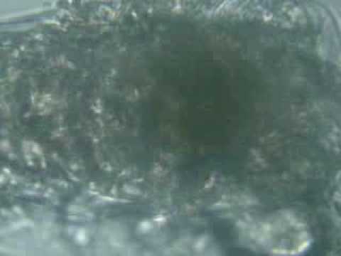 Rotifer under microscope at 400x magnification - YouTube