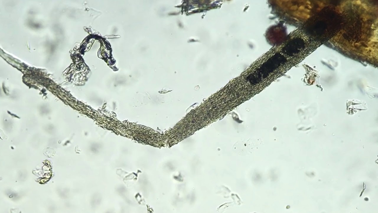 Fragmented hair in trichogram - Cat - YouTube