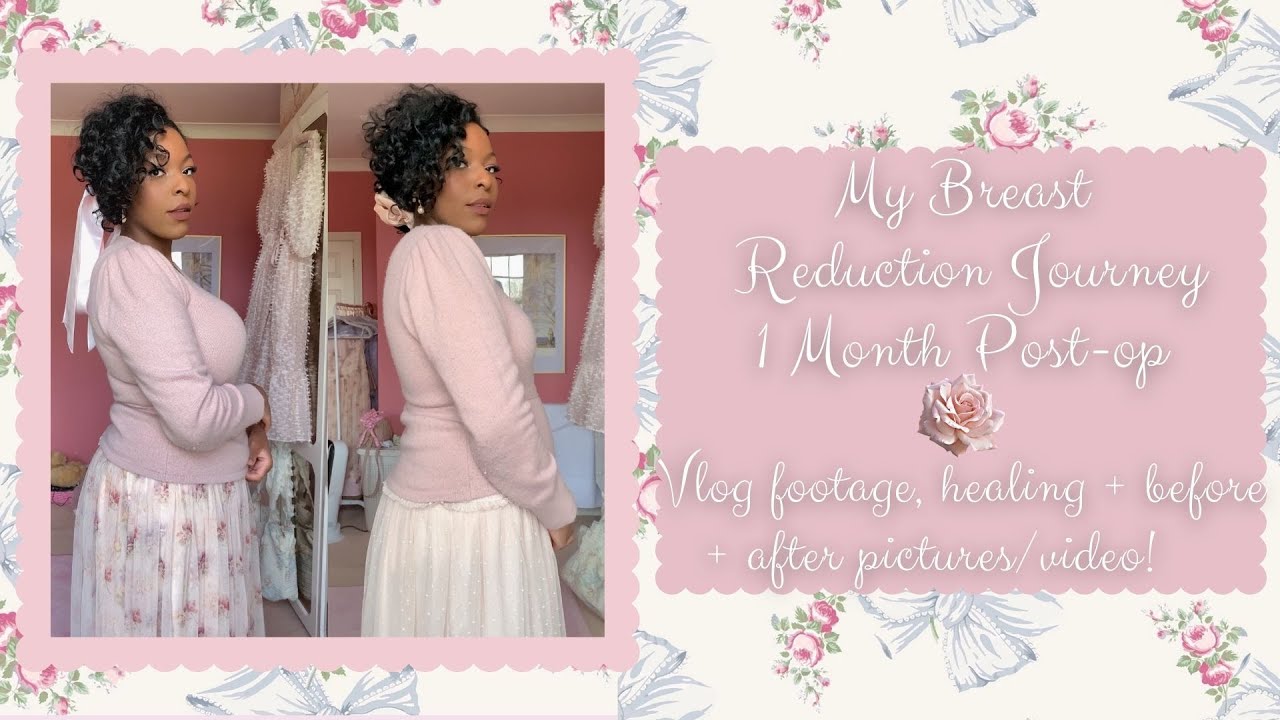 My Breast Reduction Journey 1 Month Post Op Vlog Healing Regrets