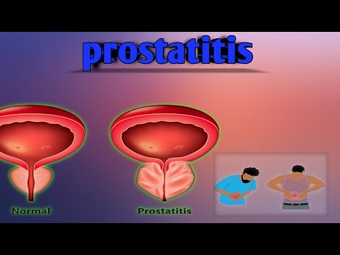 Prostatitis (Prostate Inflammation) | Causes| Signs & Symptoms ...