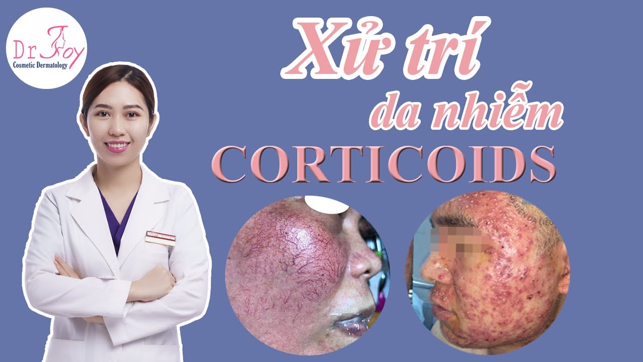 CHĂM SÓC VÀ ĐIỀU TRỊ DA NHIỄM CORTICOIDS- Skincare and Treatment for ...