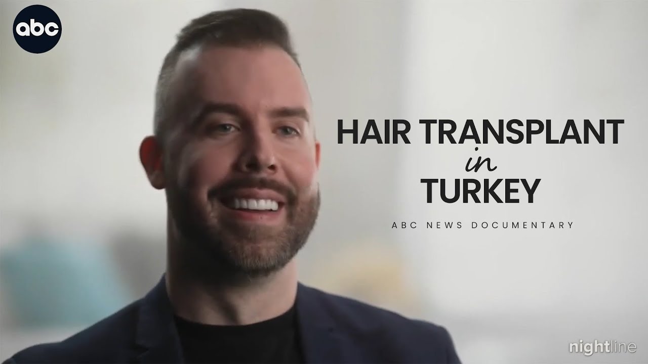 ABC News: Hair Transplant in Turkey Documentary - YouTube