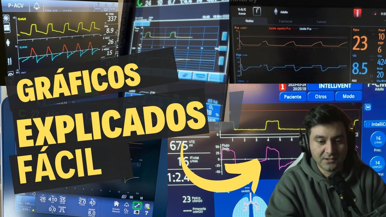 Gráficos- Curvas y Bucles del ventilador mecánico Explicados FÁCIL ...