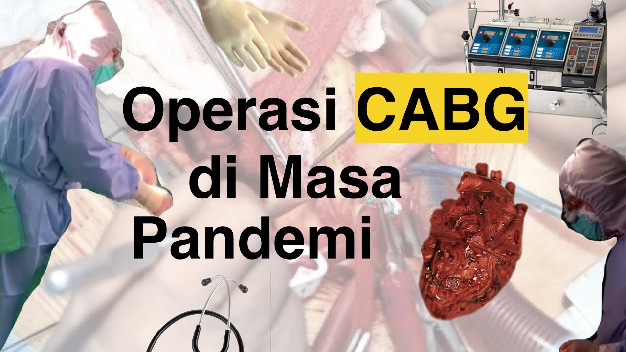 OPERASI DI KALA PANDEMI COVID-19 Ep. 2 : Coronary artery bypass ...