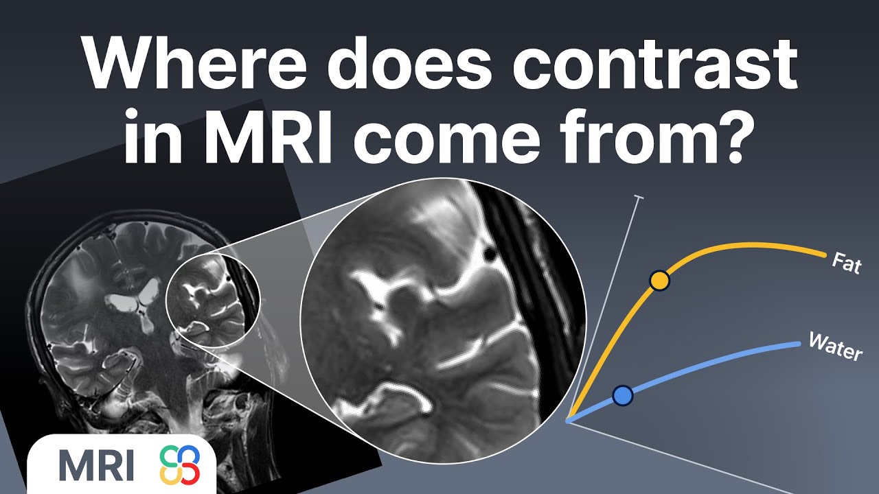 Where does the contrast in an MRI image come from? - MRI physics ...