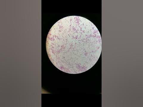 Microscopic view of Escherichia coli bacteria in compound light microscope under oil immersion ...