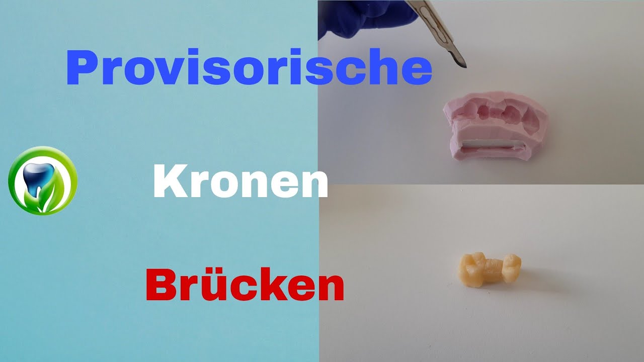Provisorische Kronen und Brücken mit Patientenfall | Versorgungsabdruck ...
