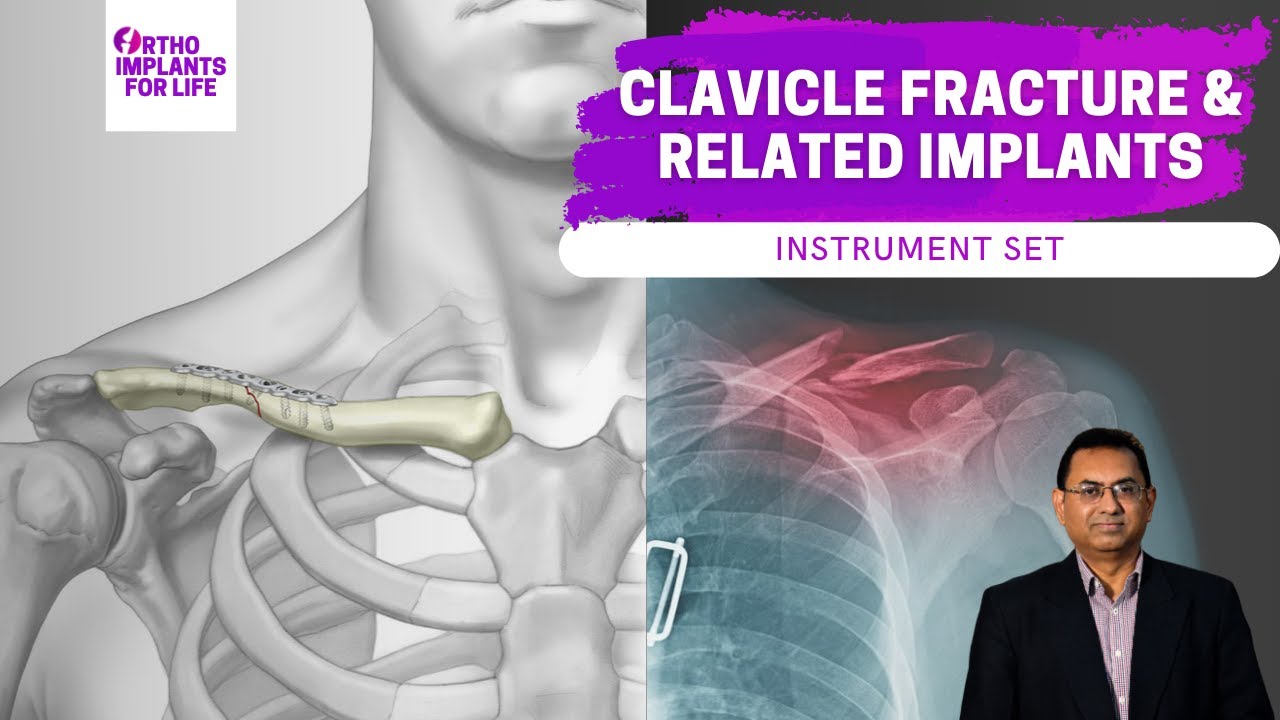 Clavicle or Collar Bone Fracture Related Implant & Instruments - YouTube