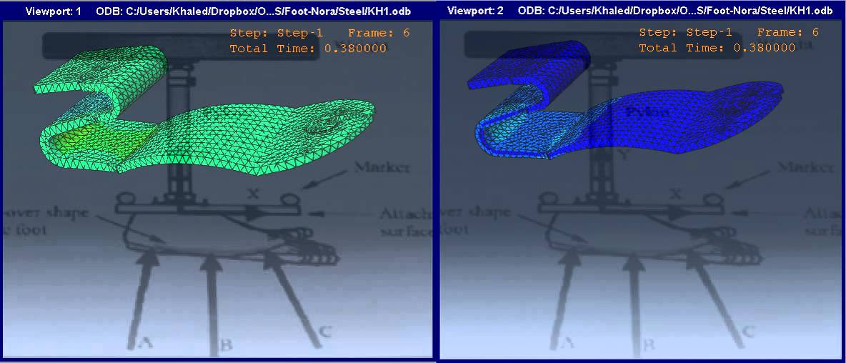 Nonlinear Finite Element Modeling of Lower Limbs (Foot) Using Abaqus ...