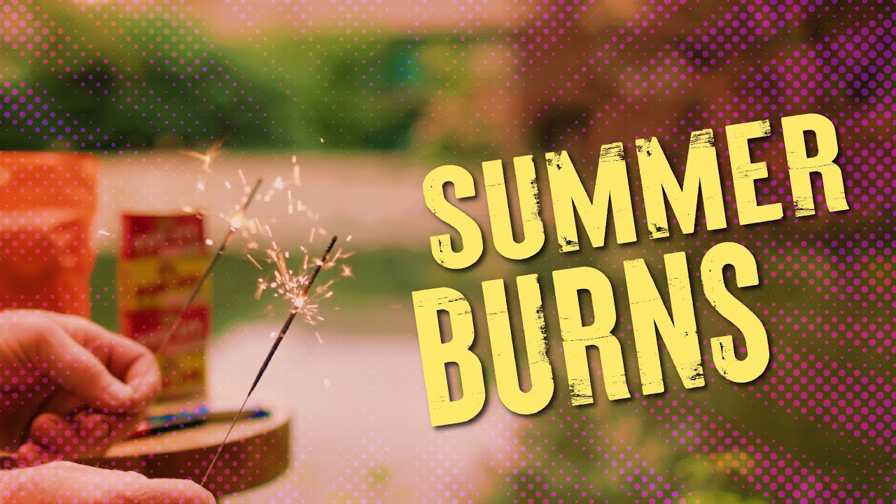 Summer Burn Safety - YouTube
