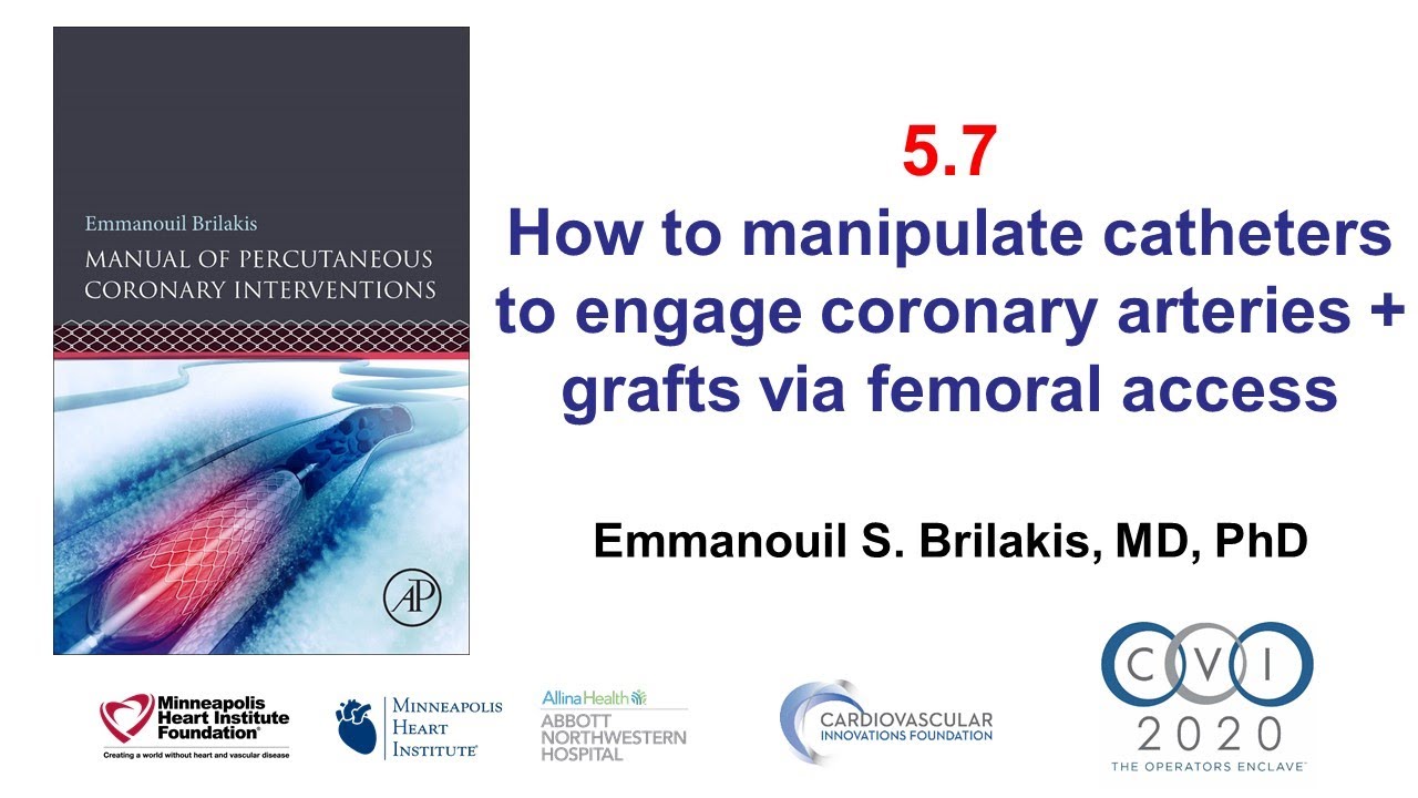 5.7 Manual of PCI - How to manipulate catheters to engage via femoral ...