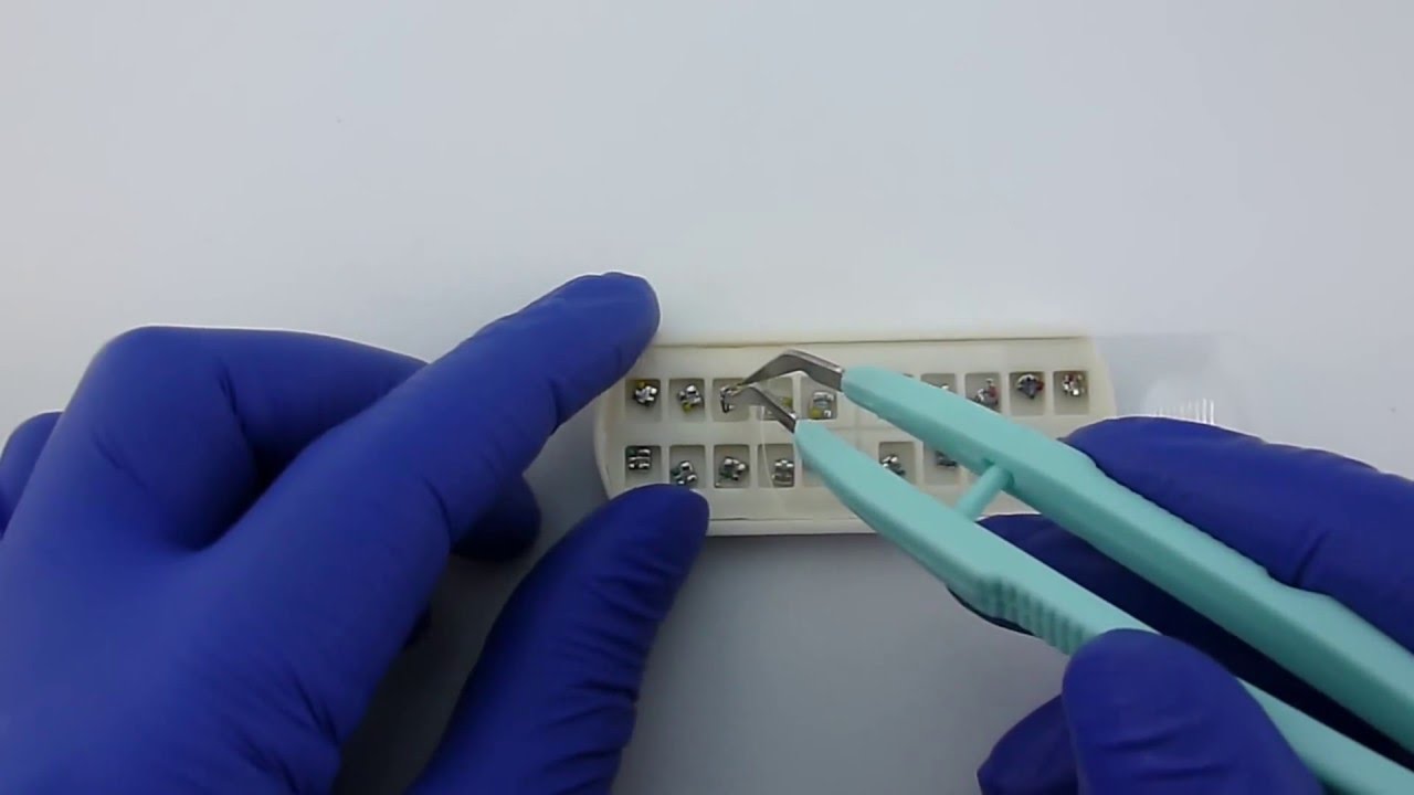 brackets orthodontics EDGEWISE ORTHODONTIC METAL BRACKET METAL BRACES ...