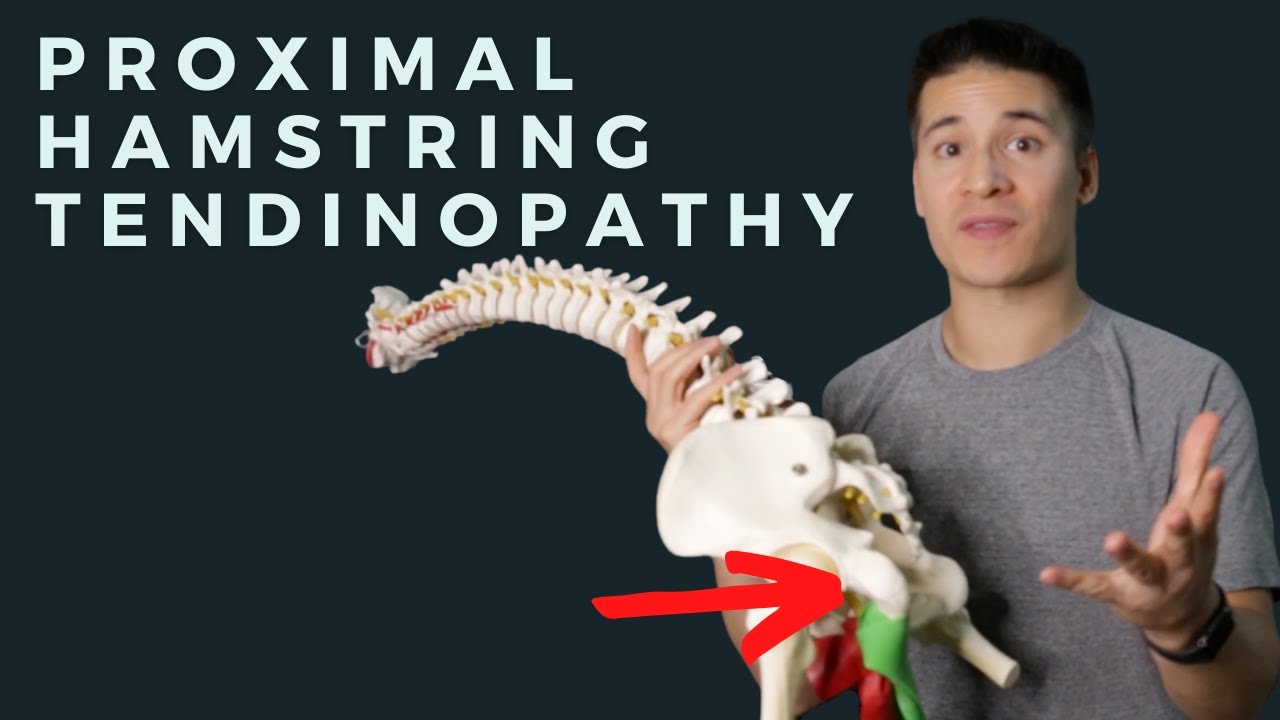Diagnosis and Treatment Proximal Hamstring Tendinopathy [Updated ...