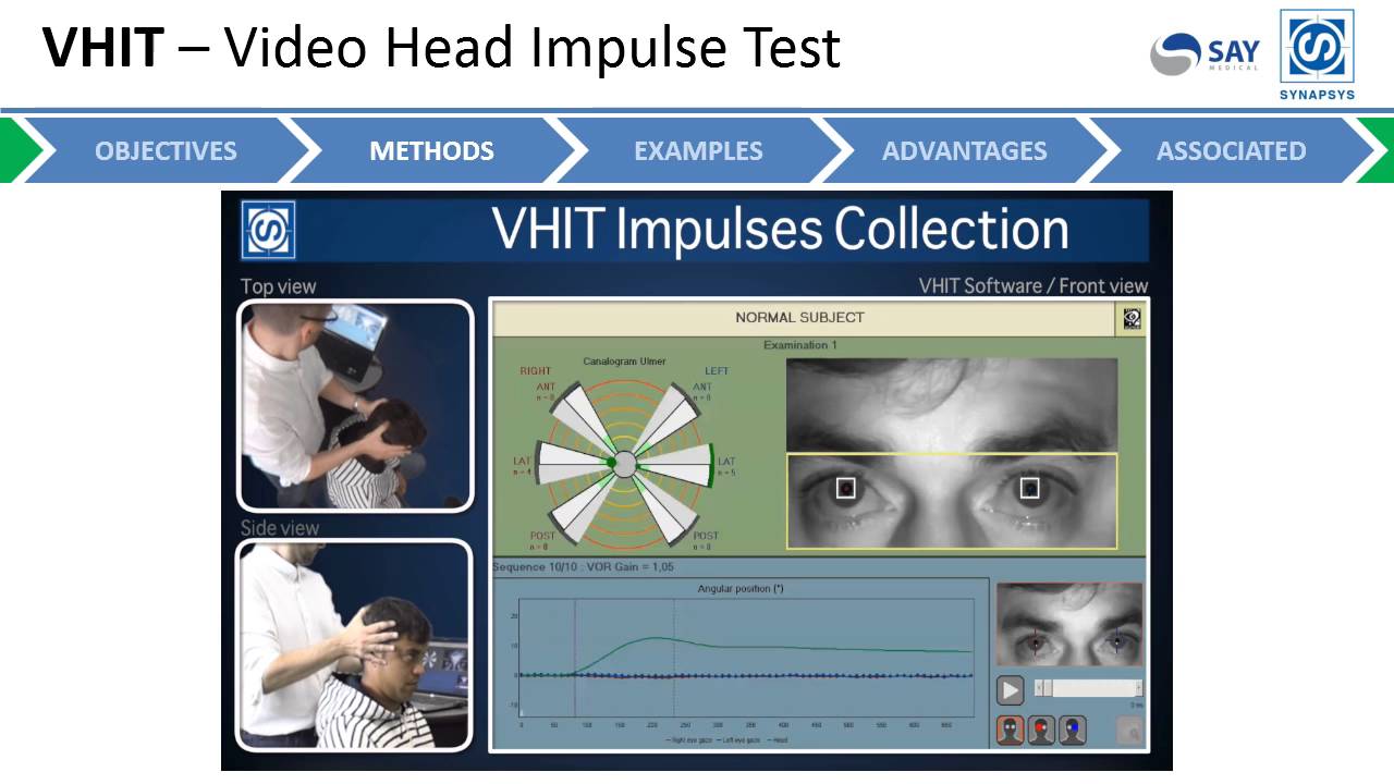 VHIT Ulmer - YouTube