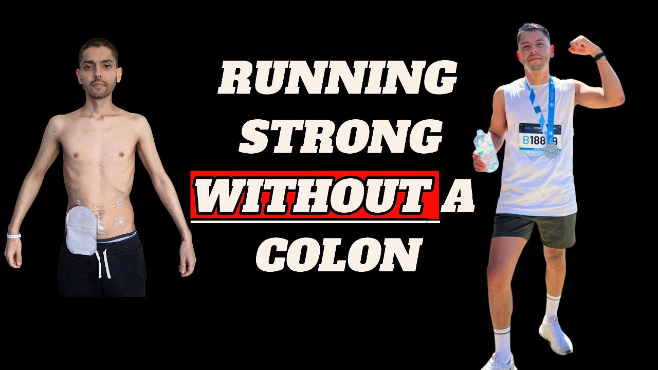 From almost DYING to Running Marathons with a STOMA bag! Here is my ...