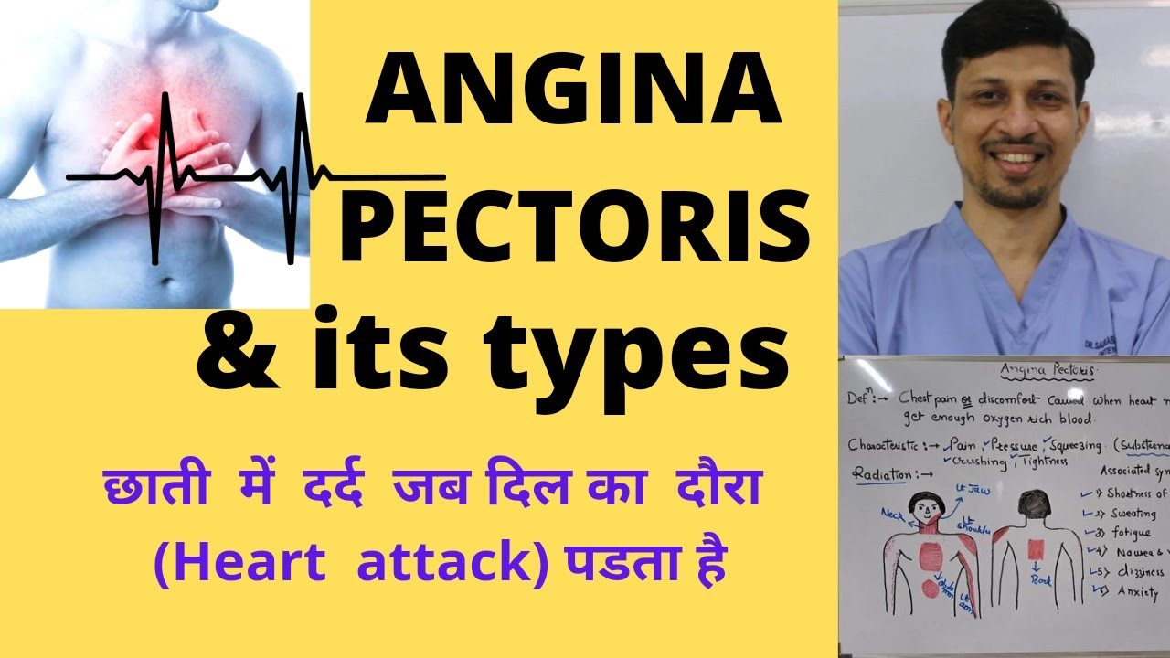 Angina Pectoris in hindi/Angina symptoms/Angina pectoris ...