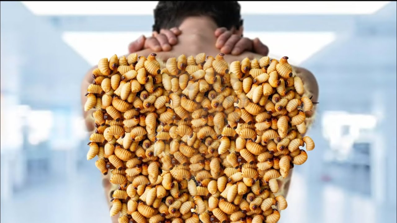 ASMR Removal Worm 🐛 & Maggots clean infected human body back asmr 2d ...