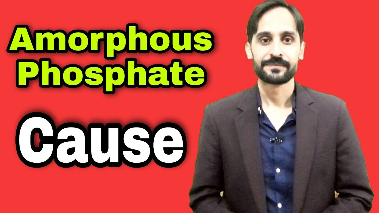 The Only Amorphous Phosphate in Urine Video You Need to Watch - YouTube