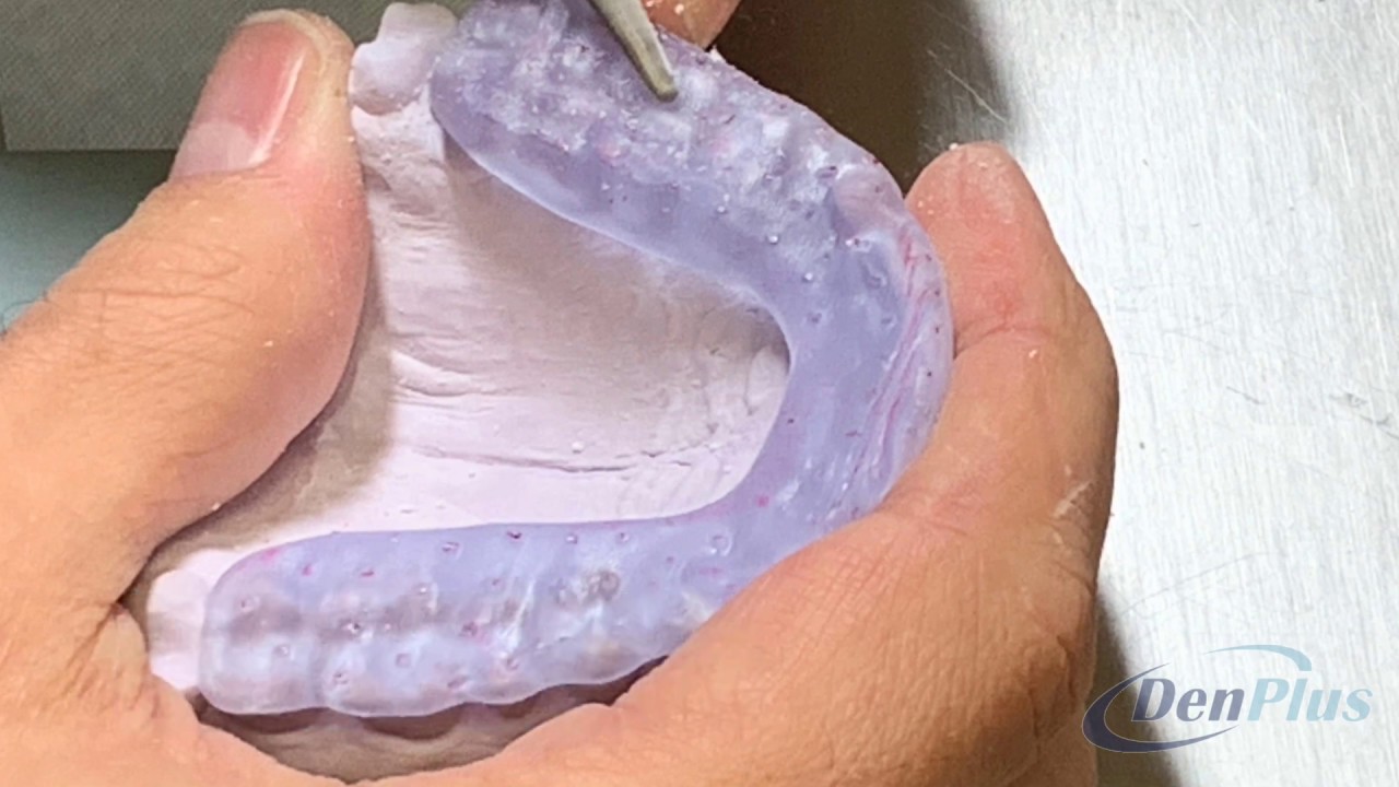 Plaques occlusales imprimées 3D - YouTube