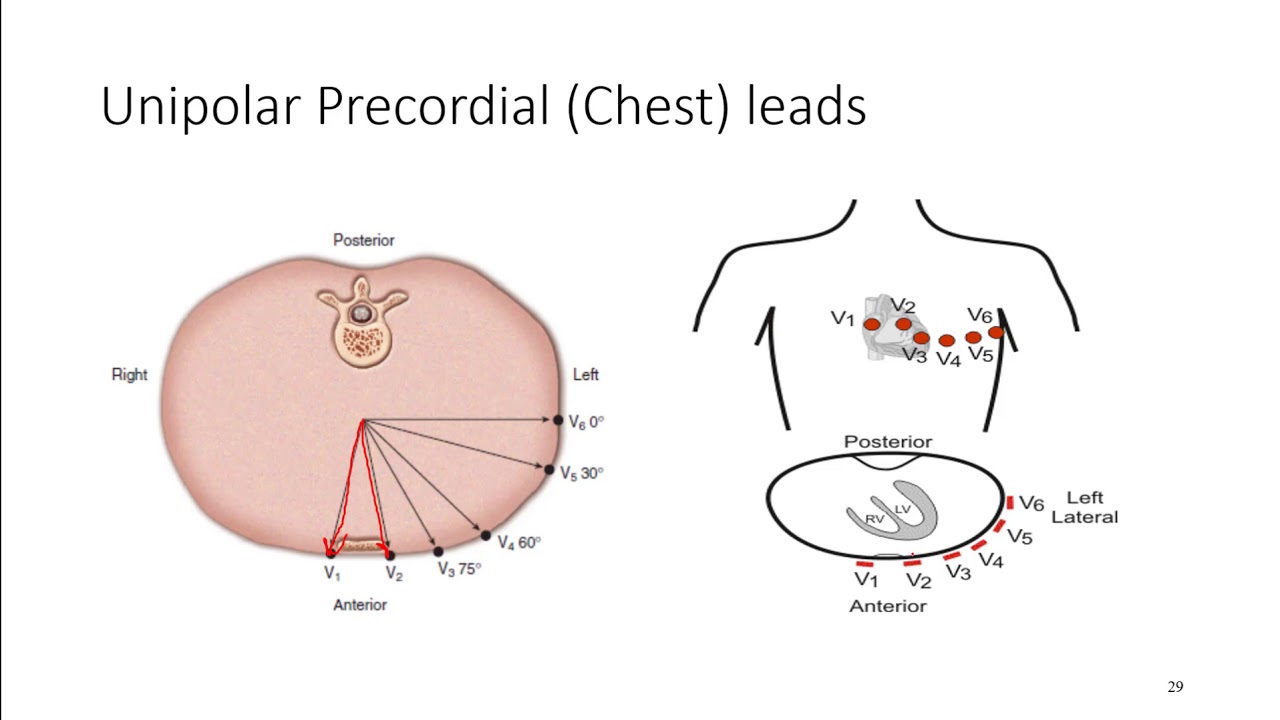 ECG 4: Leads - YouTube