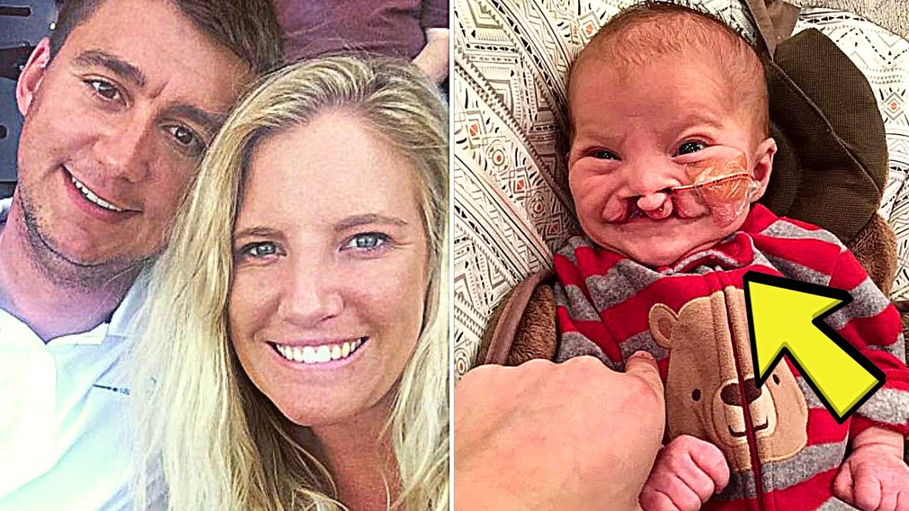 Parents Refuse To Abort ‘Deformed’ Baby — Look At Him 2 Years Later ...