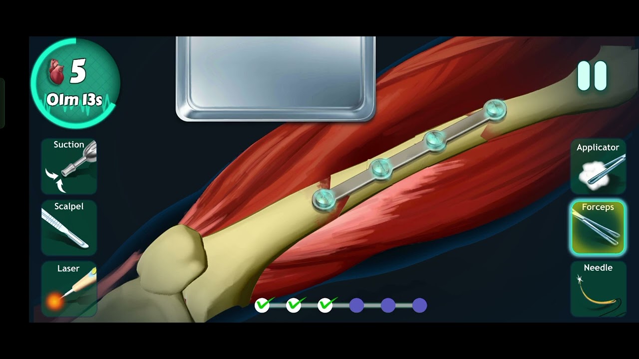Hand operation part 05 - YouTube