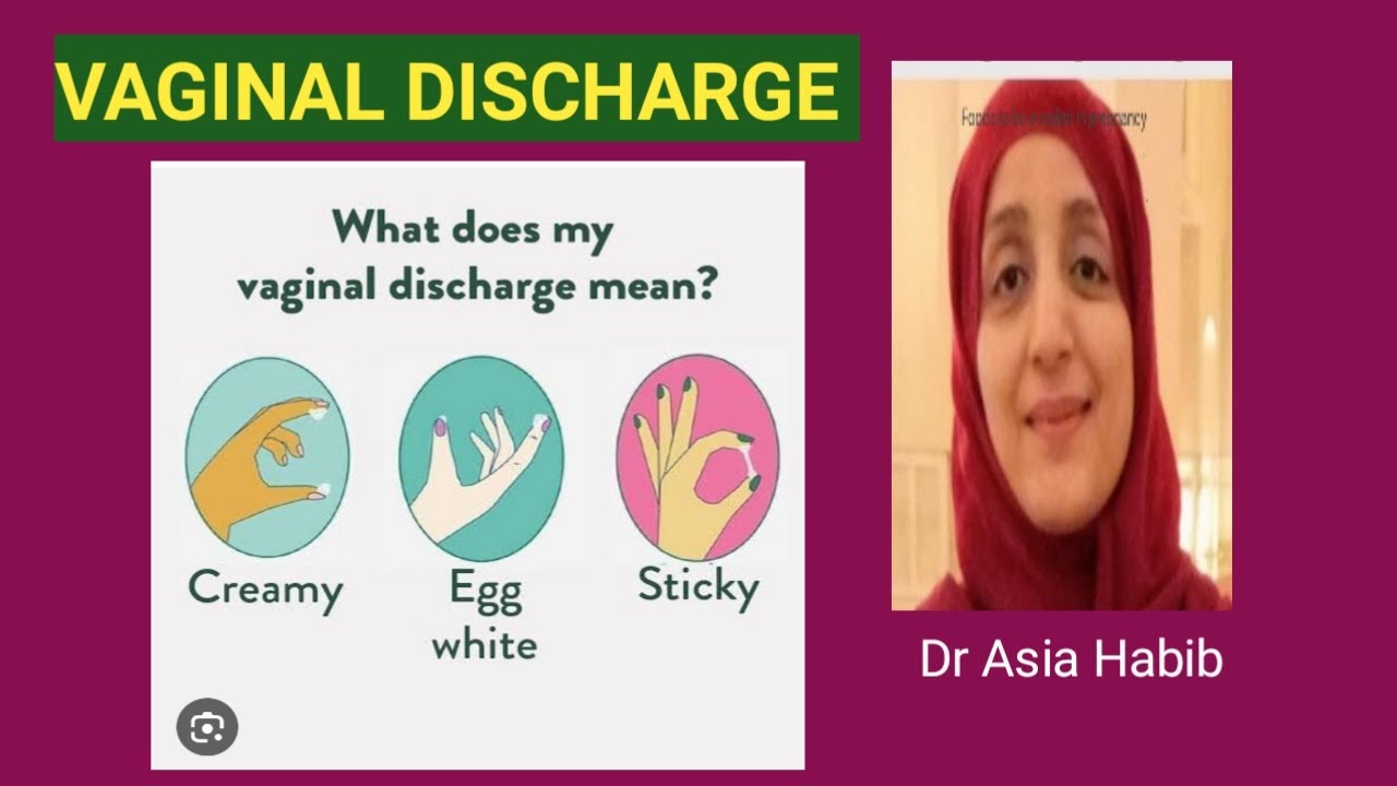 Vaginal Discharge-What's normal and abnormal |Female vaginal discharge ...