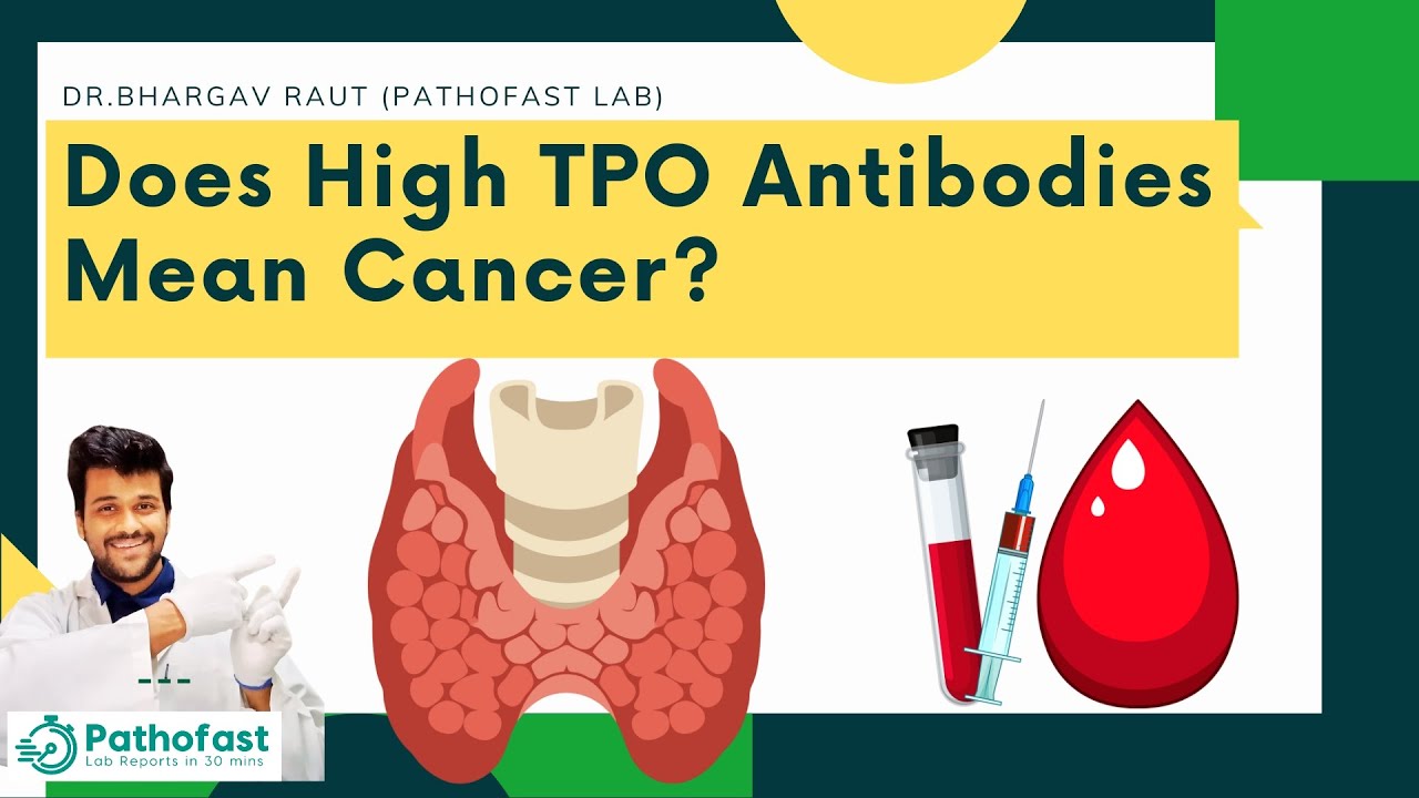 Do HIgh TPO Levels cause Cancer - YouTube