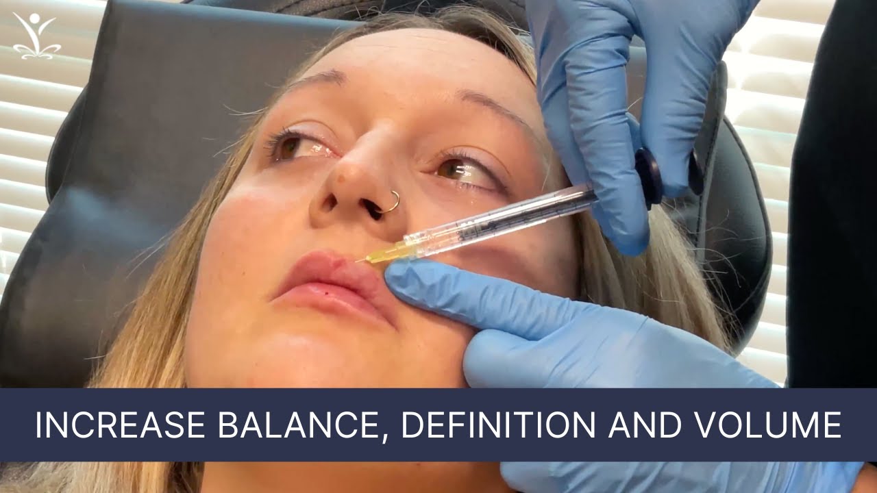 Stunning Lip Filler | Instant Results - YouTube