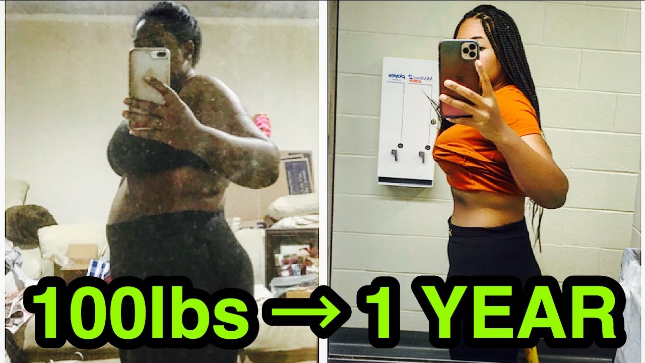 100lb Weight Loss 1 Year Body Transformation Vsg Gastric Sleeve