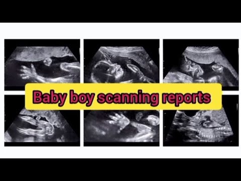 Baby boy🤰 scanning reports....my pregnancy all reports..heart beat ...