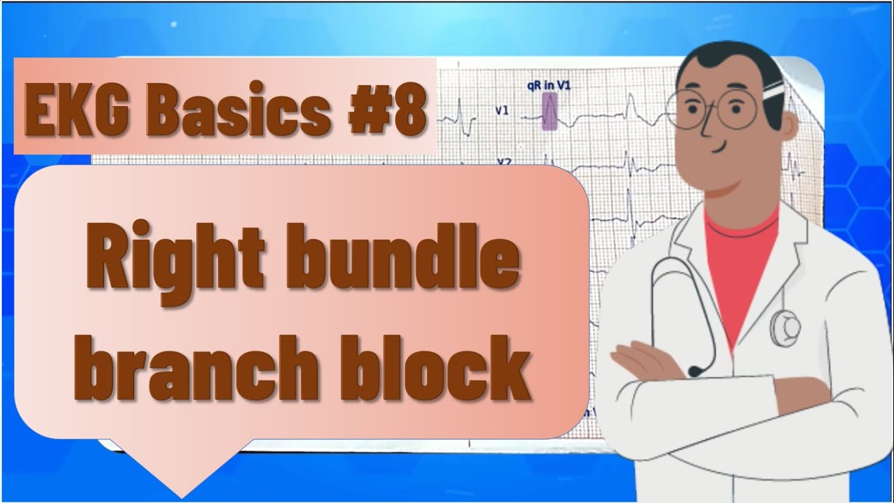 ECG basics | right bundle branch block (RBBB) | ECG findings and ...