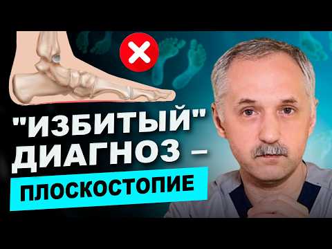 Влияние ПЛОСКОСТОПИЯ на здоровье! Что нужно знать каждому? / Доктор Виктор