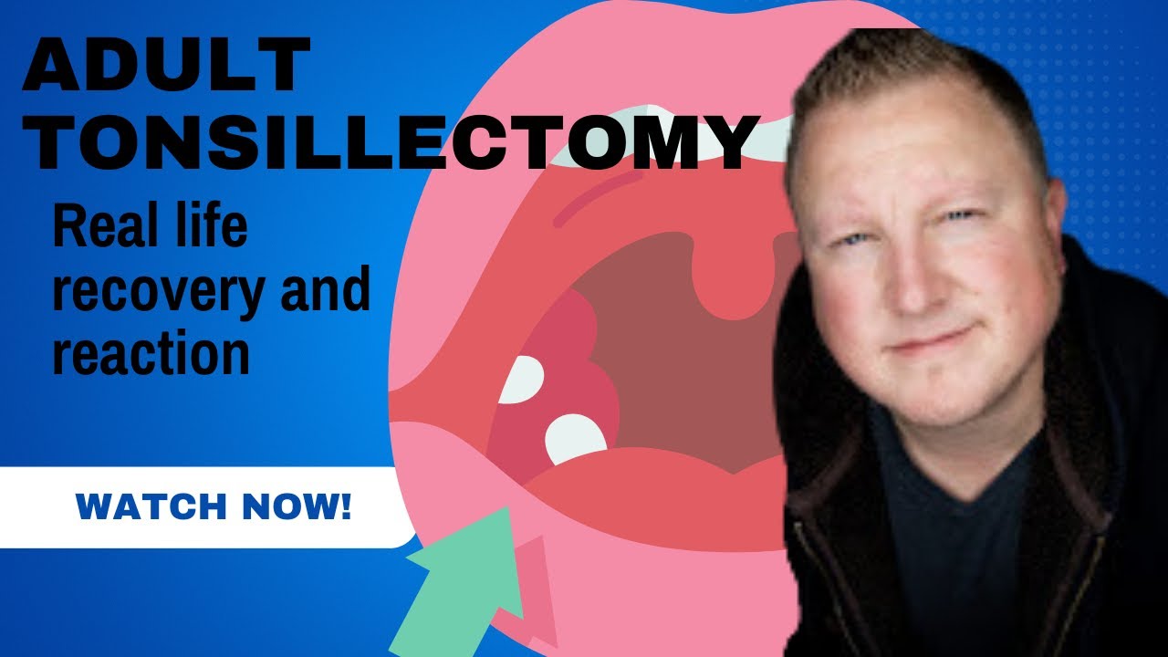 Adult Tonsillectomy Recovery and Reaction - YouTube