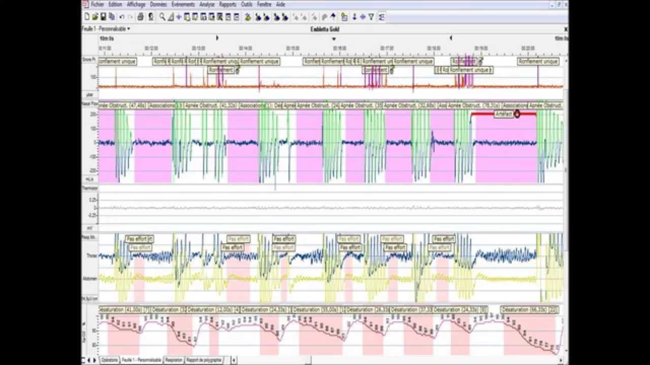 N°2 LES REGLES DE CODAGE DE LA POLYGRAPHIE - YouTube