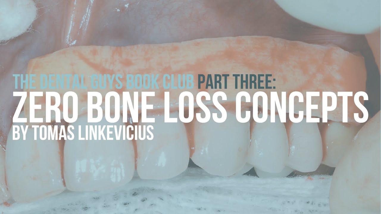 Episode 106: “The Dental Guys Book Club Part Three: Zero Bone Loss ...