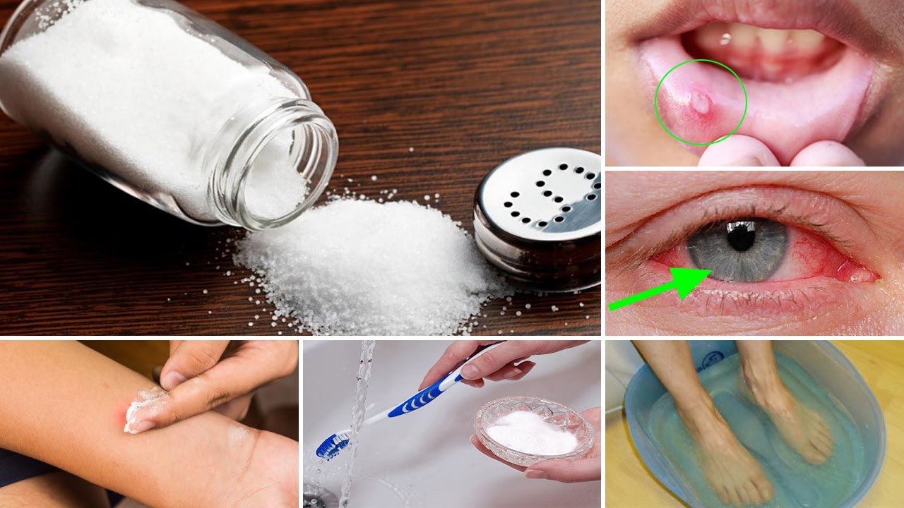 10 Unusual and Healthy Uses of Common Salt - YouTube