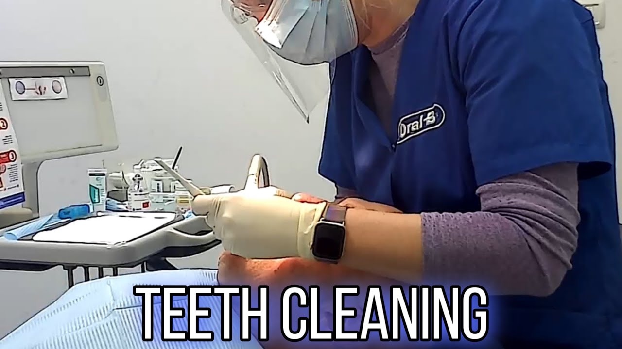 Teeth cleaning in the dental clinic/ scaling/ polish teeth - YouTube